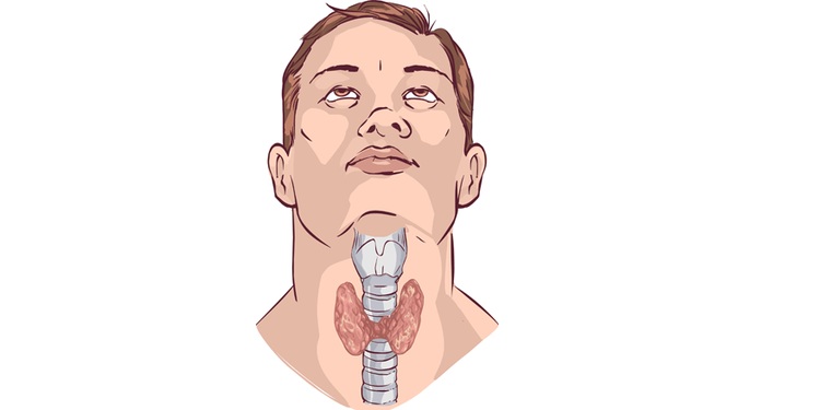 Solutions To The REAL Root Causes of Hypothyroidism - Healthdish