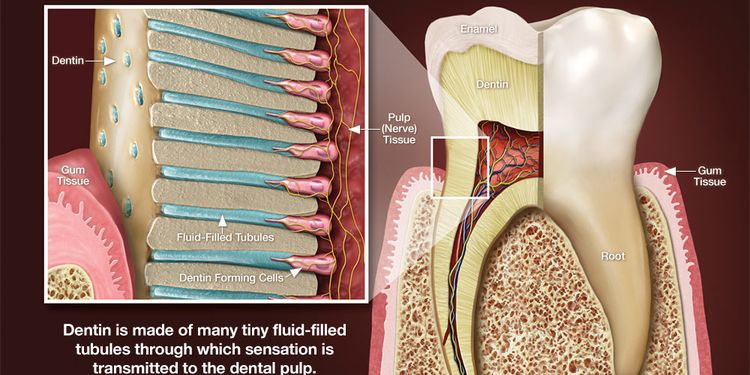 How To Heal Cavities Naturally - Healthdish