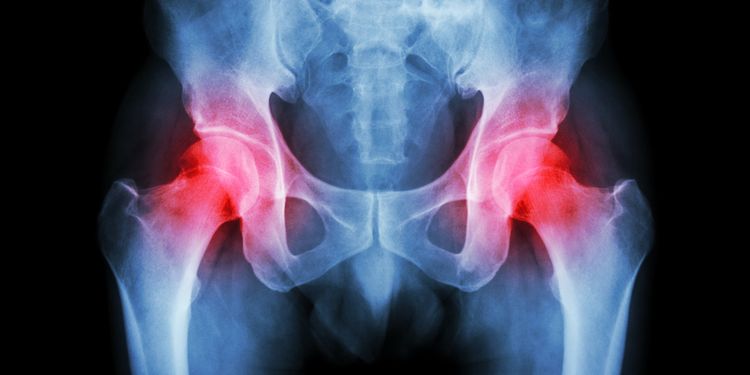 Why You Have Joint Pain and How To Beat It - Healthdish