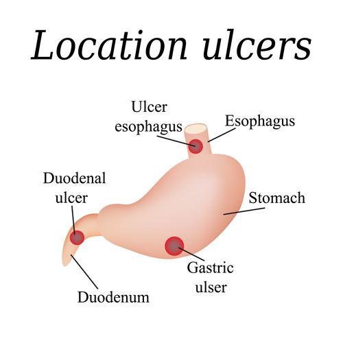 Why There's Blood in Your Stool and Next Steps - Healthdish